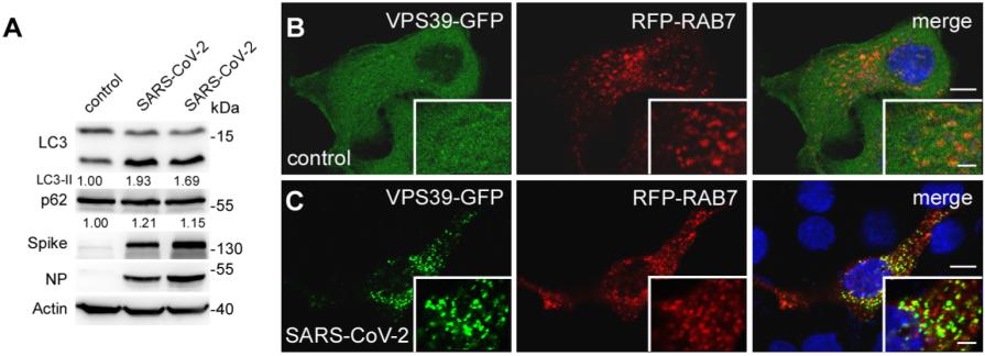 【科技前沿】张宏团队揭示SARS-CoV-2抑制自噬溶酶体形成的机制