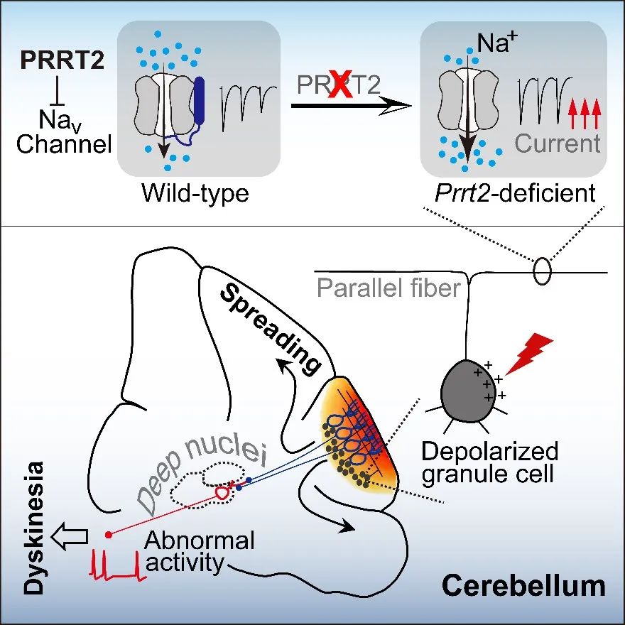 熊志奇团队揭示PRRT2基因突变导致发作性运动障碍病理机制_澎湃号·湃客_澎湃新闻-The Paper