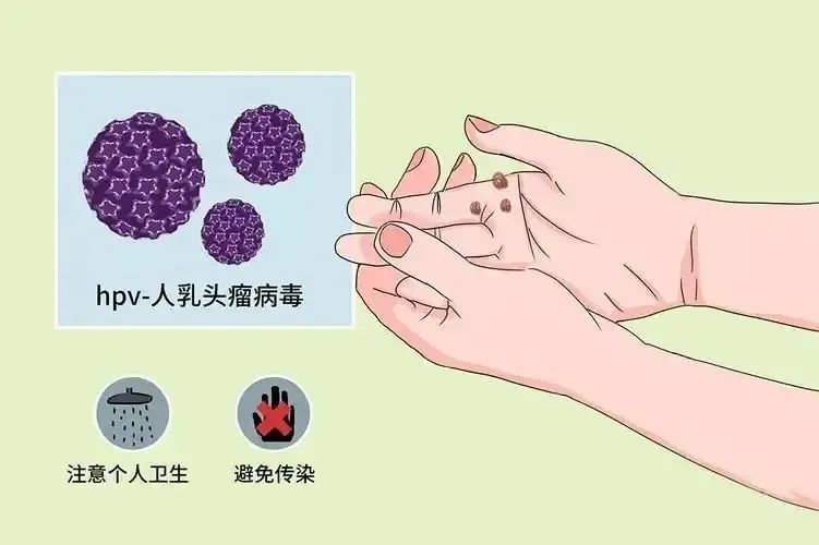 孩子身上的TA，竟是感染了HPV?_澎湃号·政务_澎湃新闻-The Paper