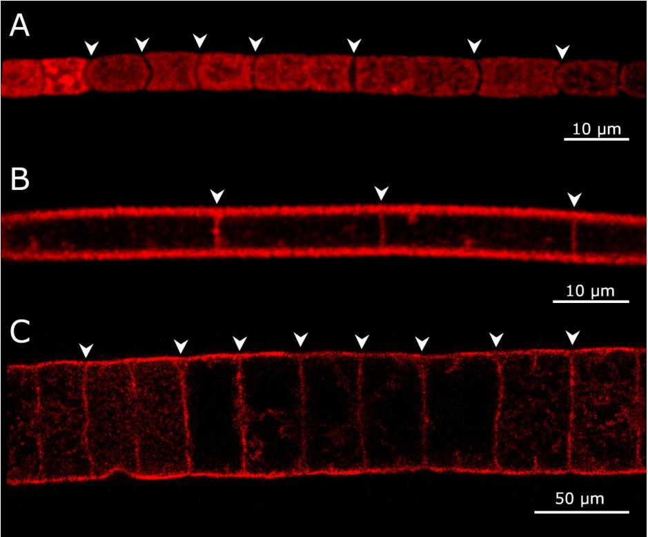 Science：解密早前发现的史上最大细菌