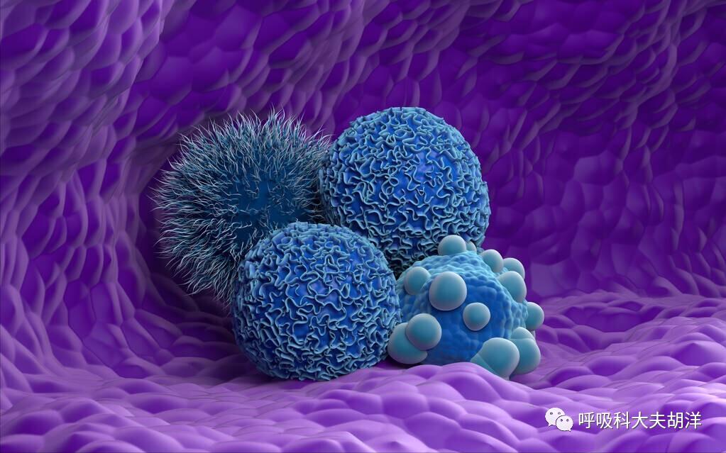 早期肺癌术后病理提示有气道播散，是不是意味着容易发生转移？_澎湃号·湃客_澎湃新闻-The Paper