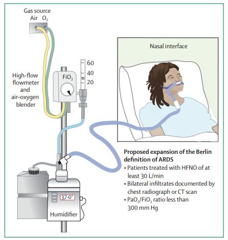 白肺要命？这份“治疗手册”请收下_澎湃号·湃客_澎湃新闻-The Paper