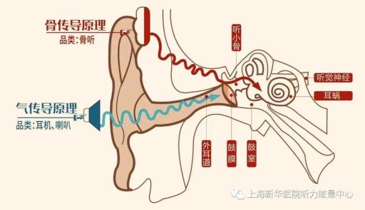 爱耳特辑 | 了解助听器，助力更好聆听_澎湃号·湃客_澎湃新闻-The Paper