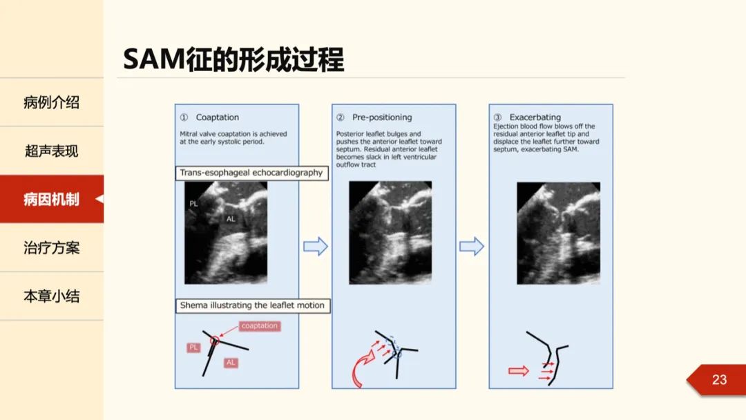 SAM现象：是什么？为什么？怎么办？_澎湃号·湃客_澎湃新闻-The Paper