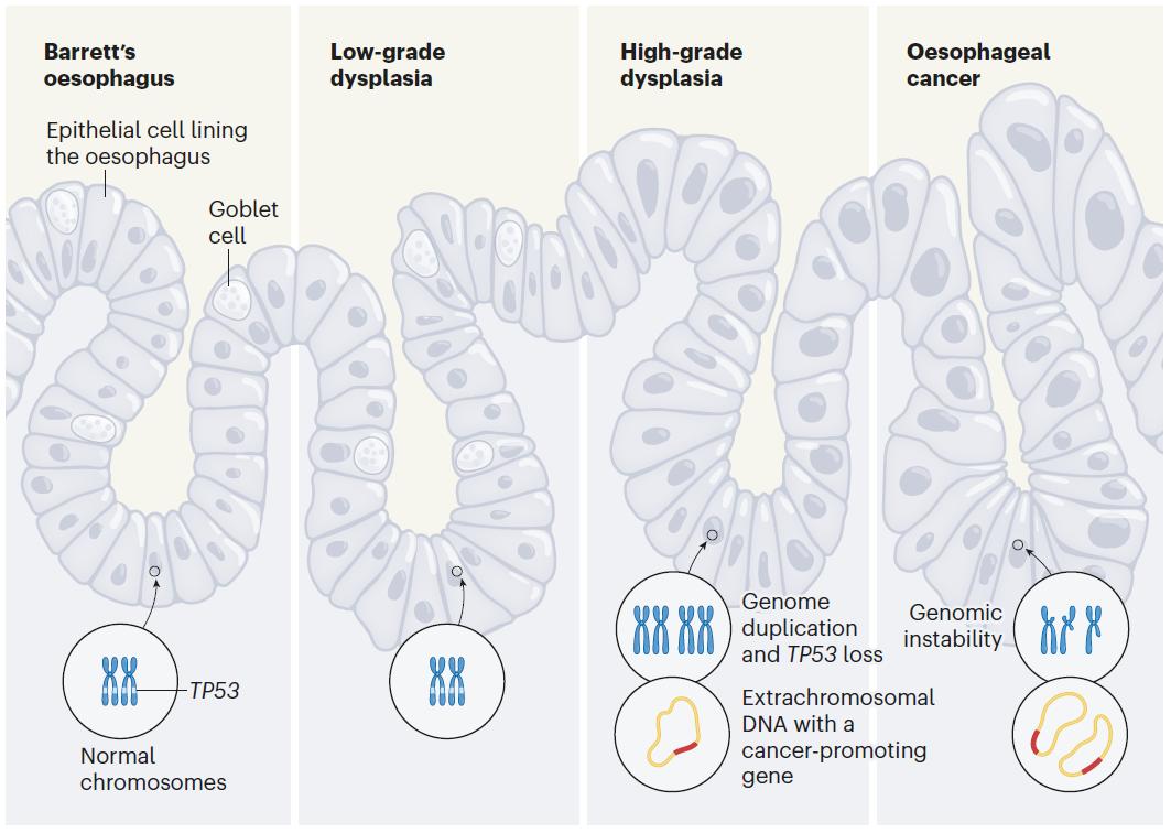 Nature：吴思涵等发现非癌组织中也会出现ecDNA，并促进癌症形成_澎湃号·湃客_澎湃新闻-The Paper