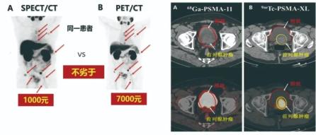 核医学分子影像探针加持的SPECT/PET/CT ,“点亮”肿瘤_澎湃号·湃客_澎湃新闻-The Paper
