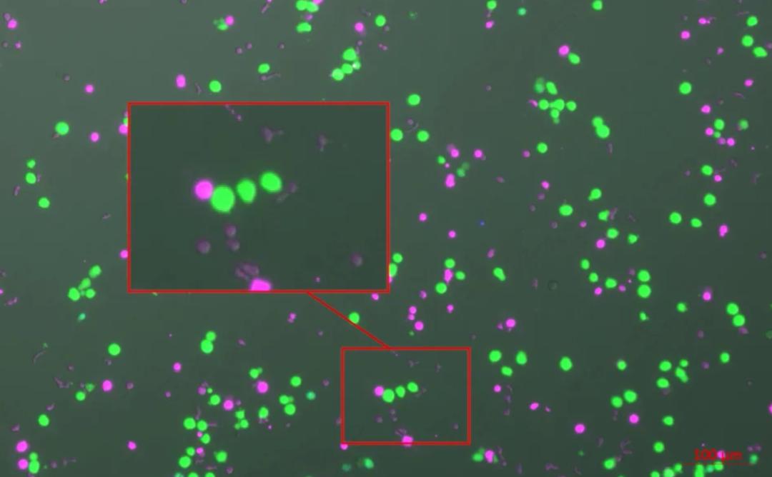 Cell重磅：余建华团队发现并解析ILC2细胞的抗癌机制，可对抗各种肿瘤，改变细胞治疗格局_澎湃号·湃客_澎湃新闻-The Paper