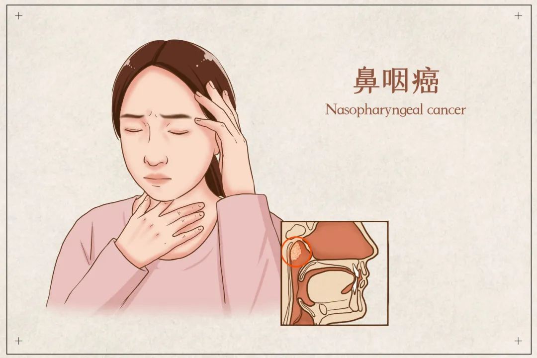 总闻到臭味，你可能被癌症盯上了_澎湃号·湃客_澎湃新闻-The Paper