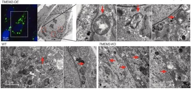 【前沿进展】Cell | Andrew Dillin课题组发现胞外基质调控线粒体及免疫激活新机制_澎湃号·政务_澎湃新闻-The Paper