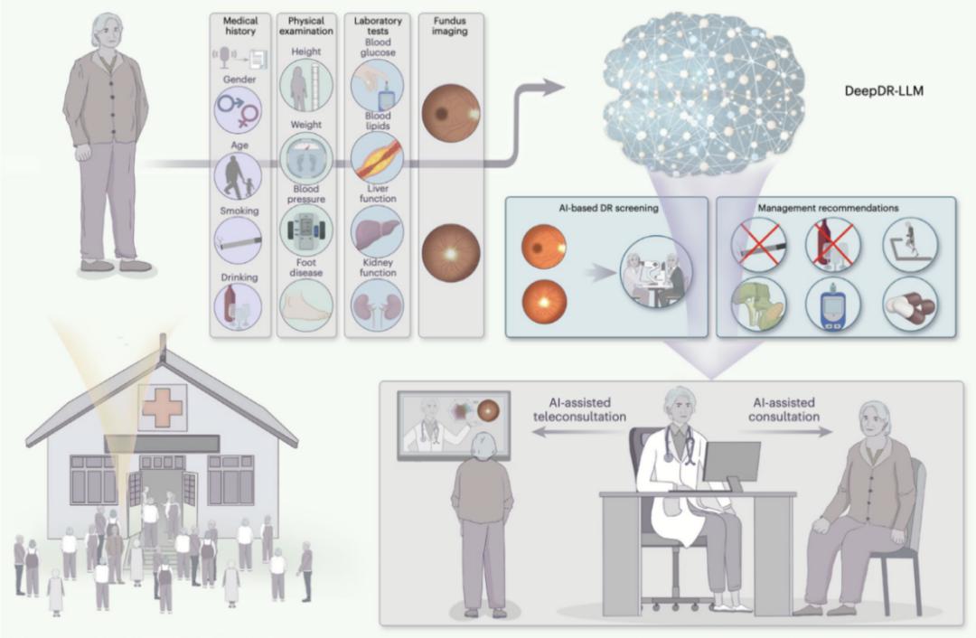 我国学者开发国际首个糖尿病诊疗多模态大模型DeepDR-LLM_澎湃号·湃客_澎湃新闻-The Paper