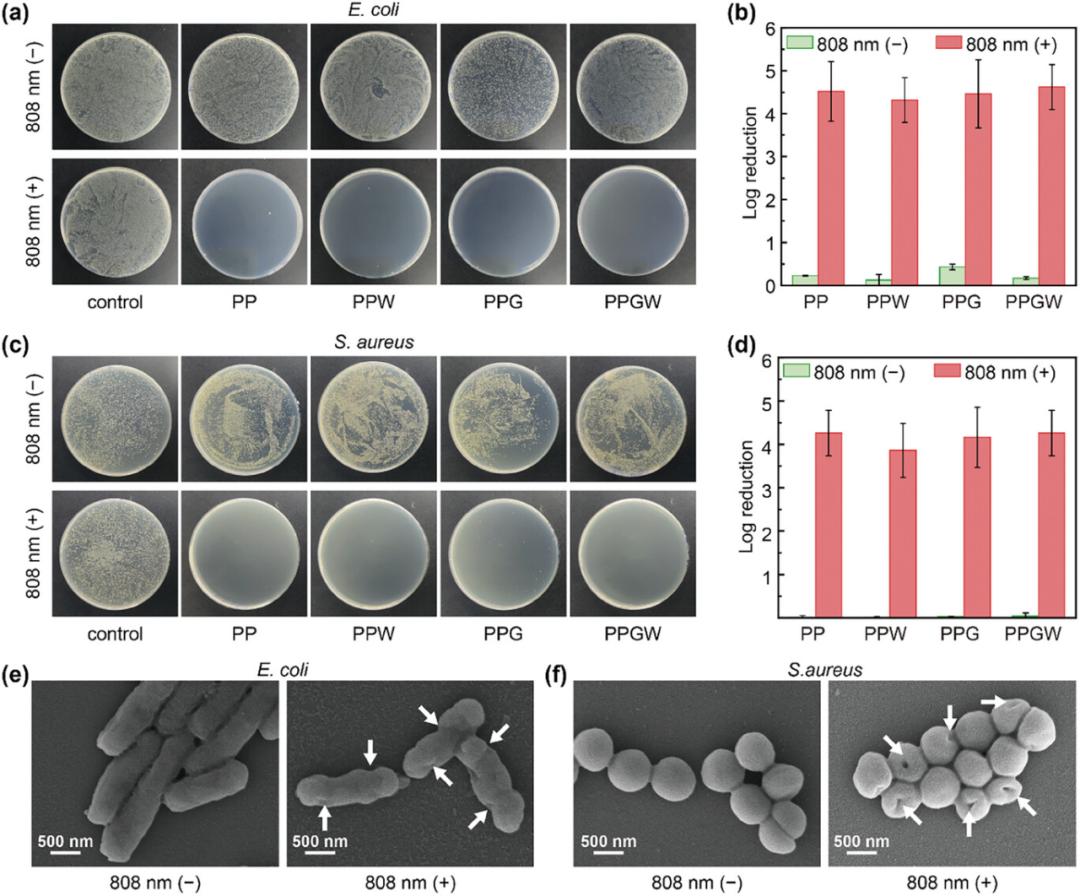 【复材资讯】西北工业大学AFM：多功能水凝胶有效促进细菌感染糖尿病伤口愈合