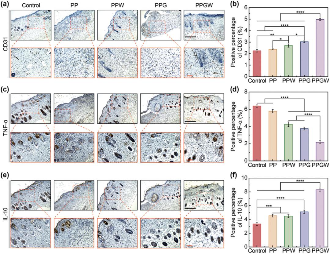 【复材资讯】西北工业大学AFM：多功能水凝胶有效促进细菌感染糖尿病伤口愈合